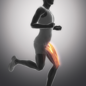 Abductor Tendinopathy - Eramosa Physiotherapy